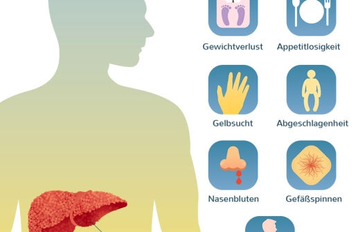 Symptome - Leberzirrhose